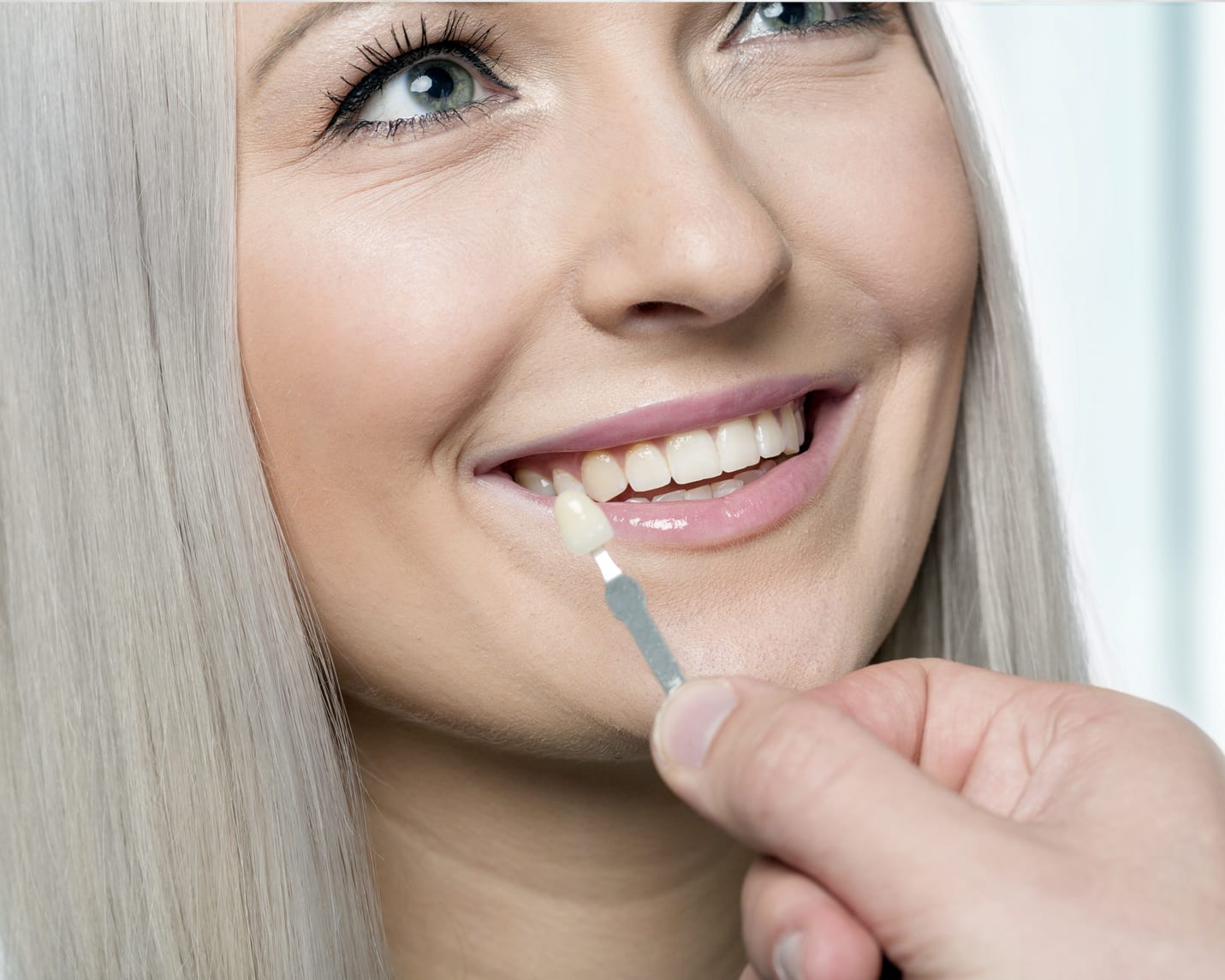 Tooth Coloured White Crowns – Govan Dental Care