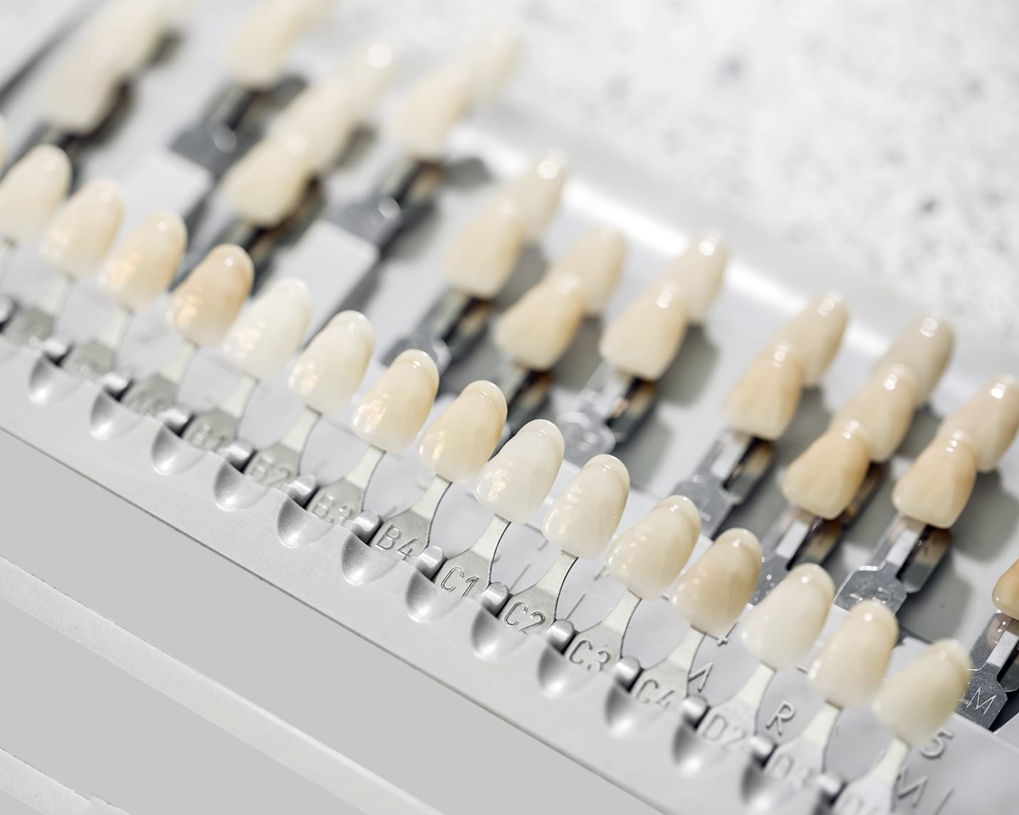 Tooth Coloured White Crowns – Govan Dental Care